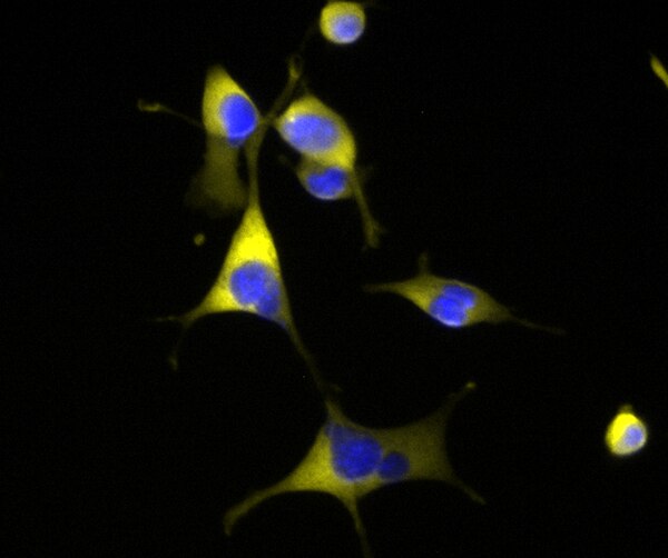 MC38 Murine Colon Adenocarcinoma Cell Line | SCC172
